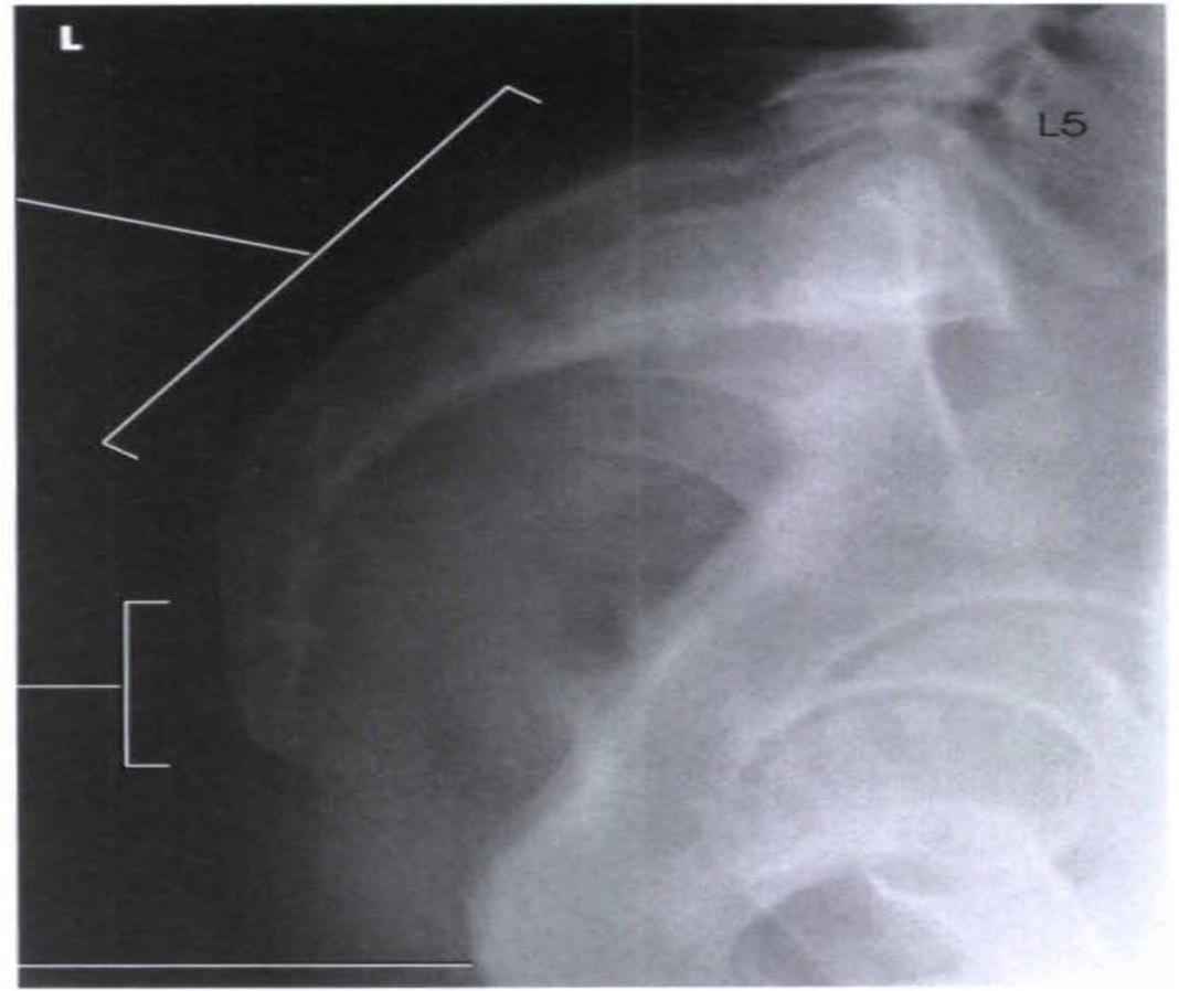AKHSANUR BLOG'S: teknik radiografi sacrum dan coccyx