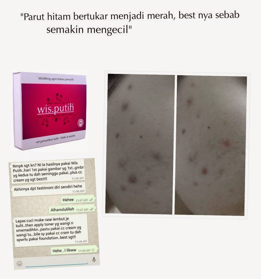 Produk Kecantikan & Kesihatan: WIS PUTIH SKINCARE FREE HYDROKINON