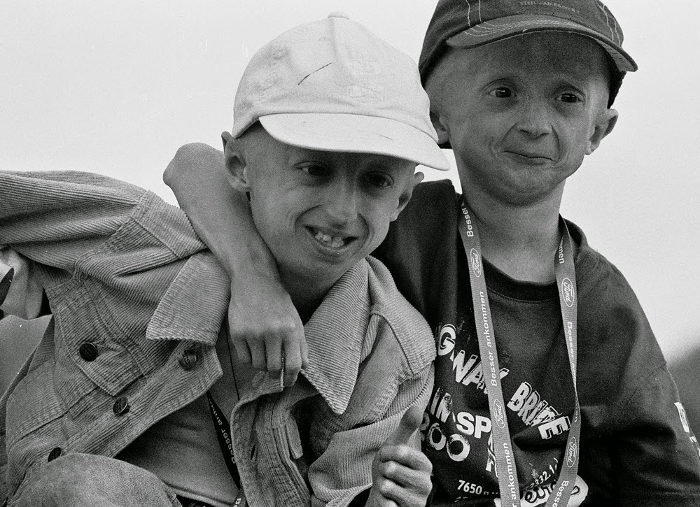 progeria family circle: bijeenkomsten