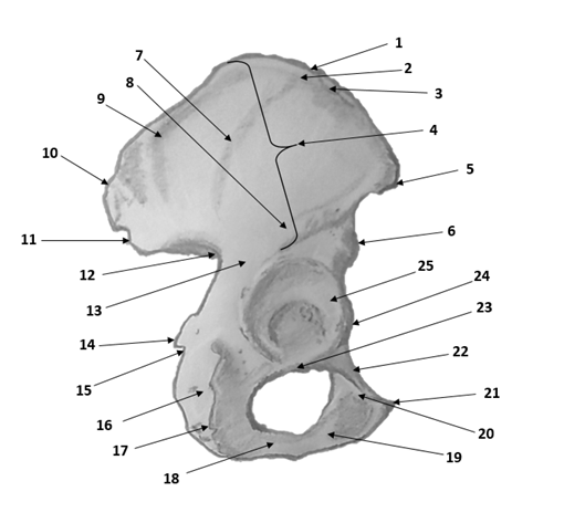 Actividad 5 - Evaluacion Final - Grupo 154003_9: 2. Miembro Inferior