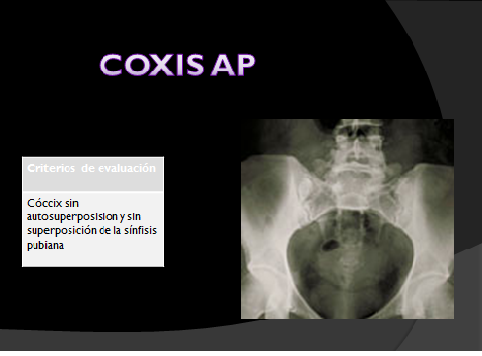 Criterios De calidad Y Evaluación De Las Imágenes radiograficas ...