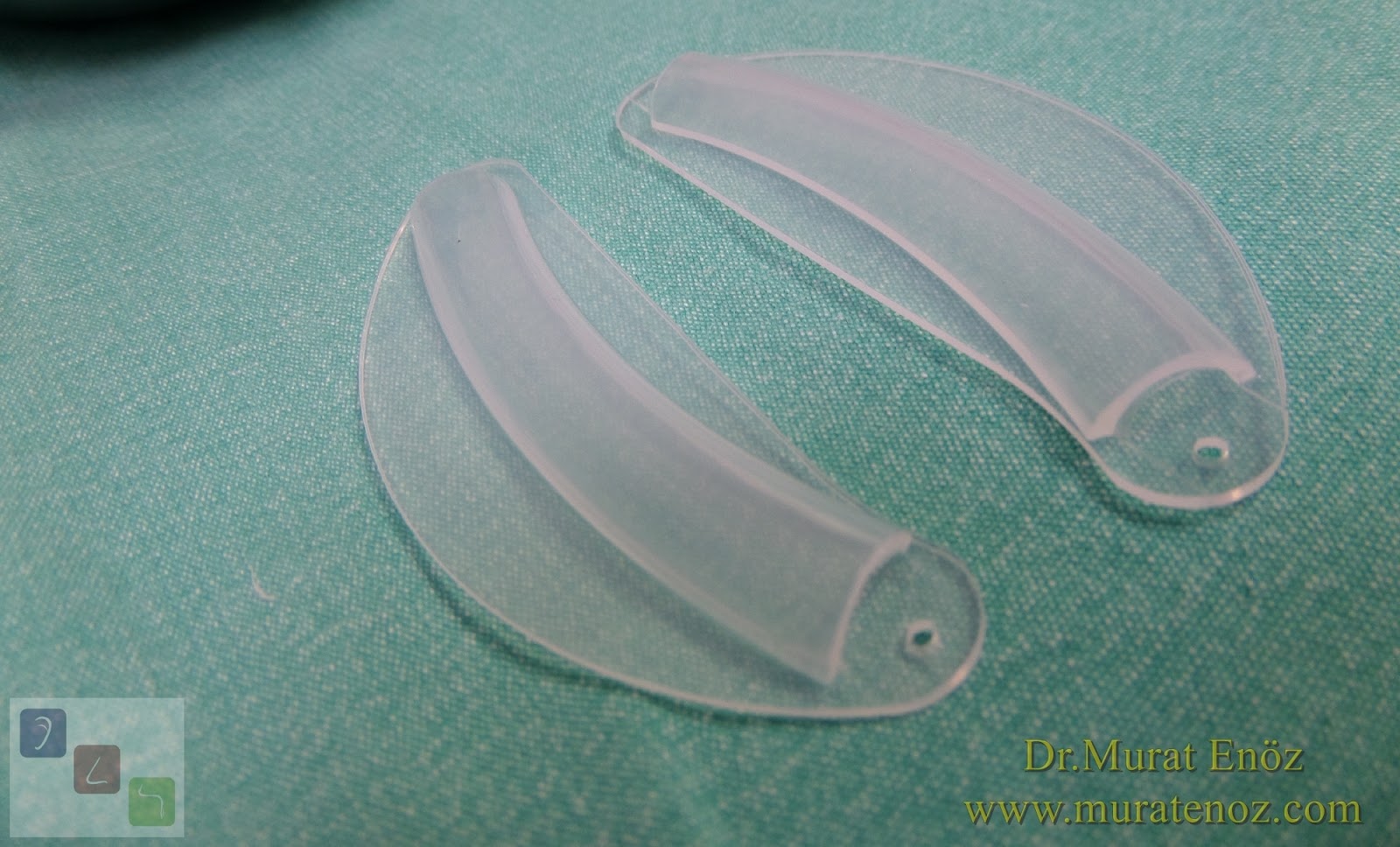 Rhinoplasty Recovery Guide 👃 - 16 - Does The Nose Become Clogged After ...