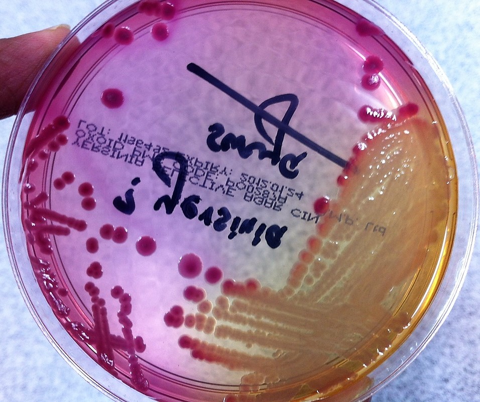 YERSINIA SPP. - Microbiology Laboratory Turkey