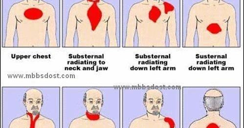 Health Tips: Chest pain and heart attack.