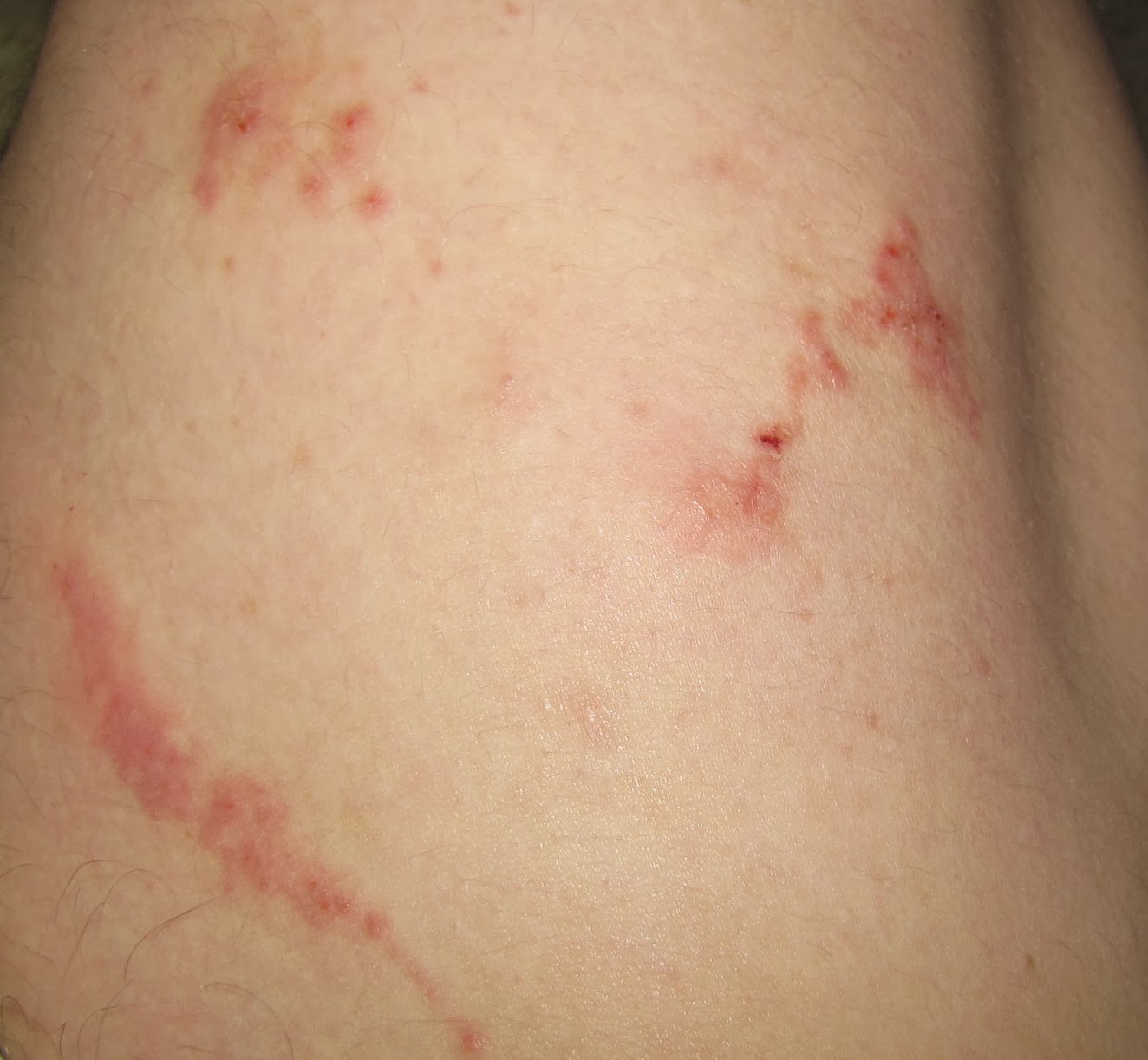 Squirrel Bot Fly Parasite Mini