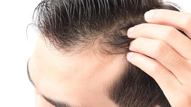 My Daily Hair Loss Treatment Routine