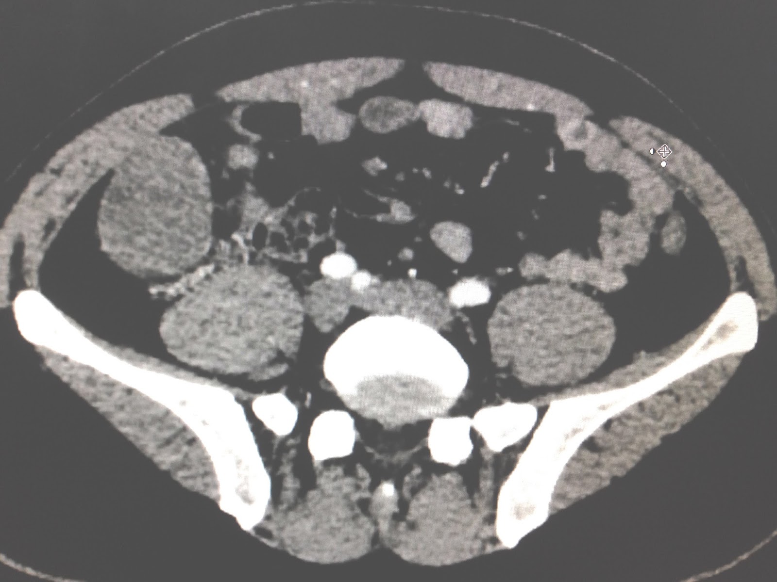 VIETNAMESE MEDIC ULTRASOUND: November 2016