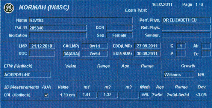 Ruthies's Journal: 8 Weeks Ultrasound Scan Photos