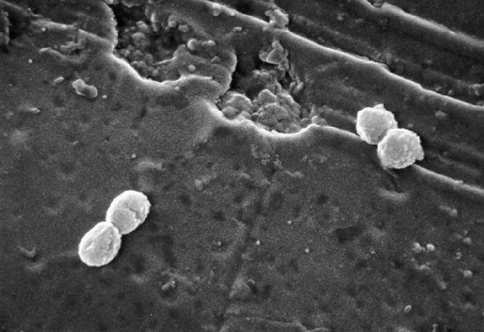 A tale of two outbreaks