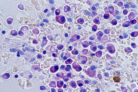 Lecture Notes in Medical Technology: Lecture #14: Blood Cell Cytochemistry