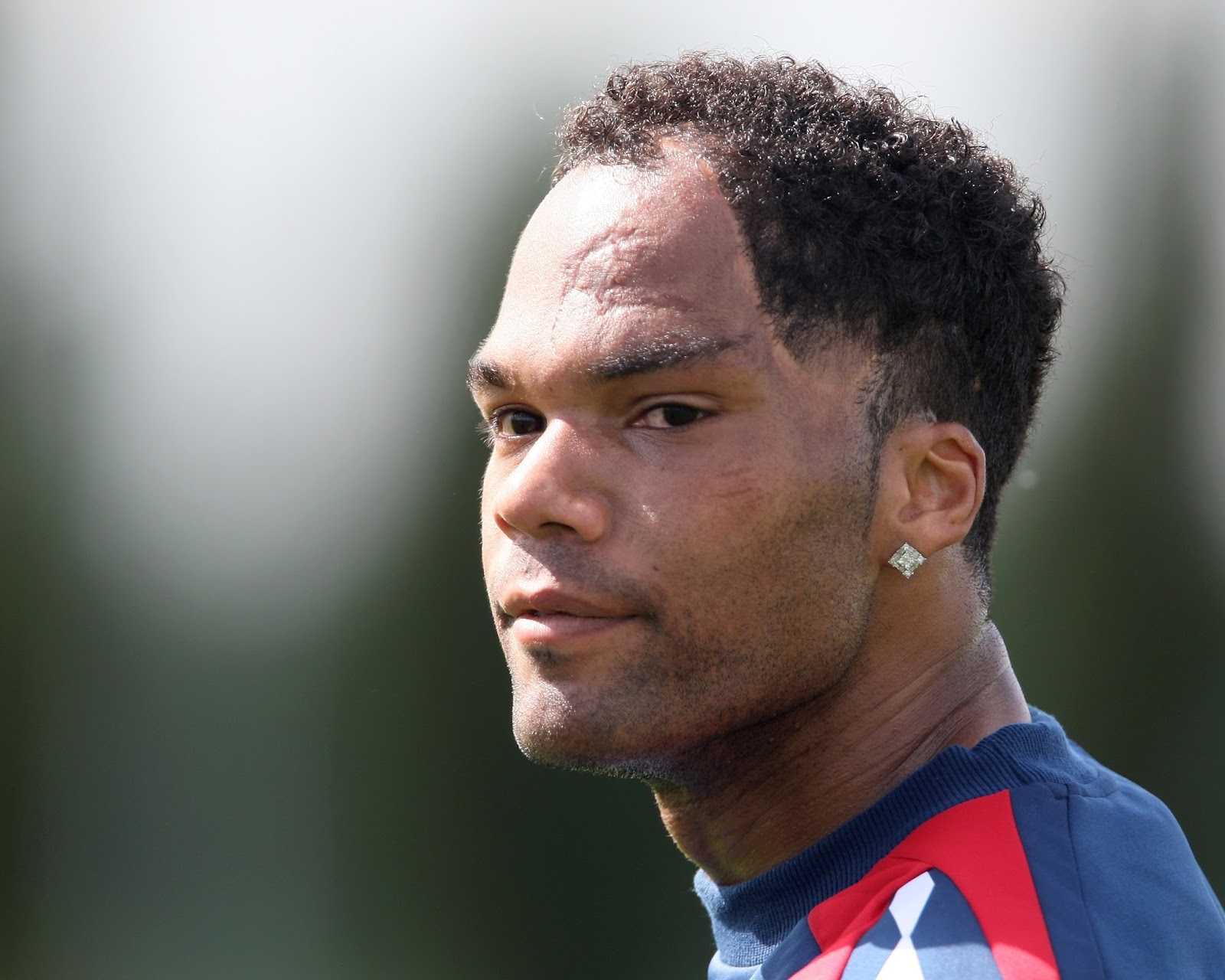 5 Footballers With Distinctive Scars | FOOTY FAIR