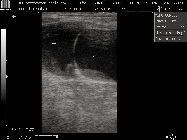 Emergências: a importância da ultrassonografia