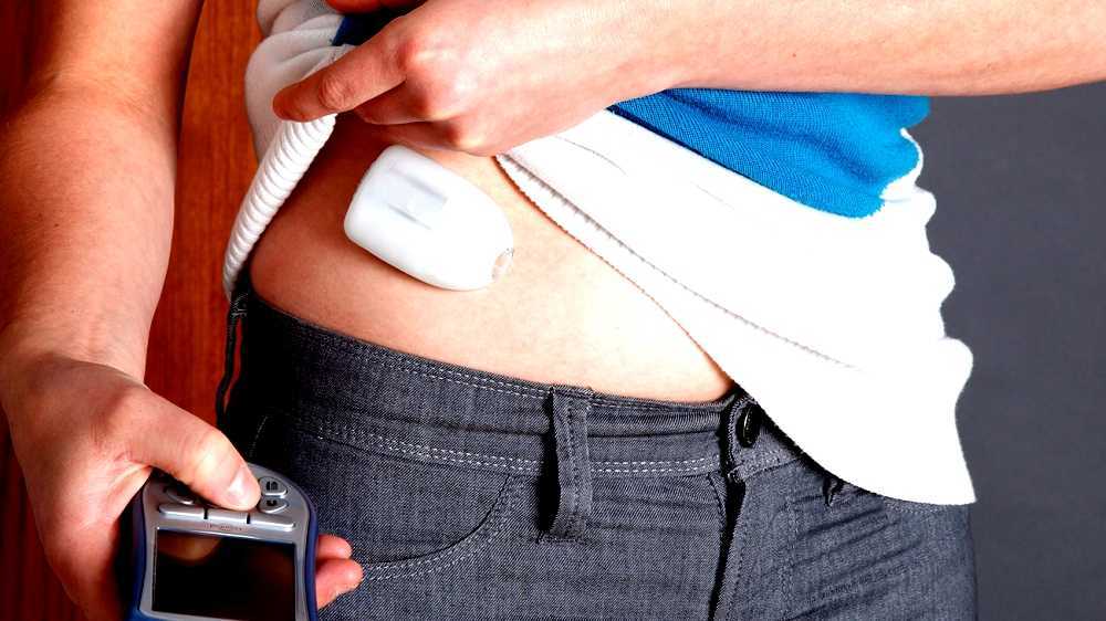 Omnipod Insulin Management System