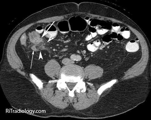 RiT radiology: August 2011
