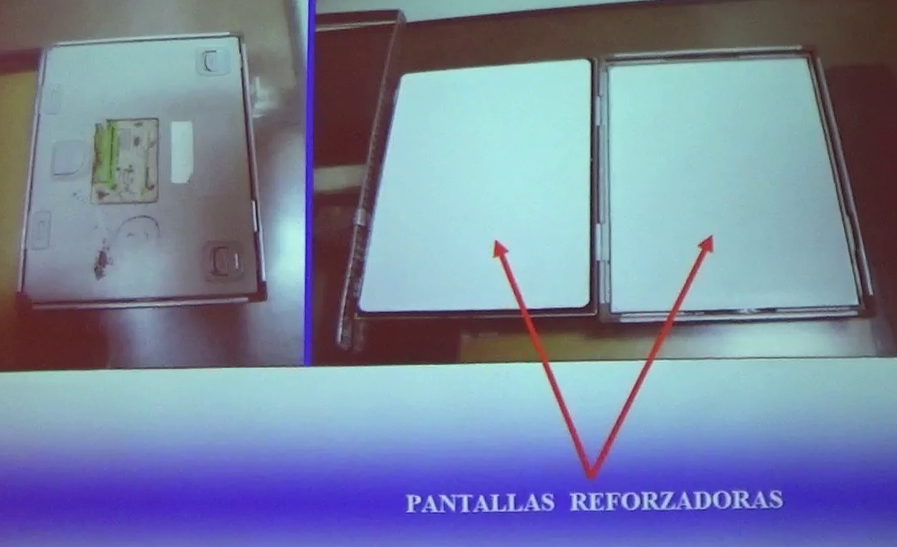 RADIOANATOMIA: PRIMERA CLASE DE RADIOANATOMIA