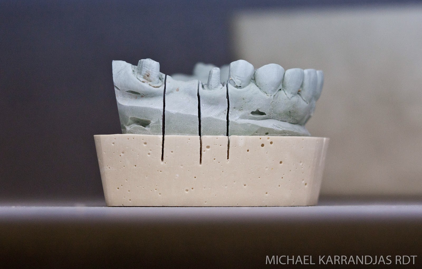 Dental Lab Model Fabrication | Making Noise And Drinking Beer