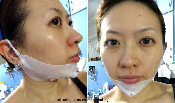 Cottonball Crusade ♫꒰･‿･๑꒱: Fugu Face Pt 2 - Bijinsenmon Slimming Face ...