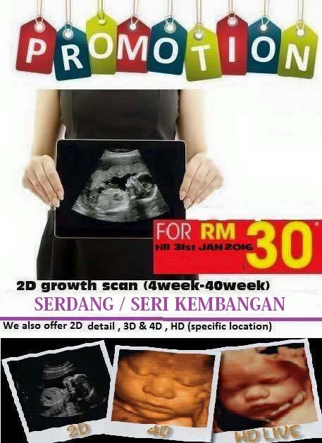 haihayahai: Pengalaman Mengandung : 2D scan di Klinik Sofea Puchong
