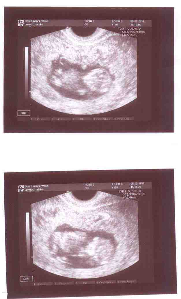 Wunder im Bauch: 12.SSW - Schon im 4. Monat und ein Grund zum Feiern!