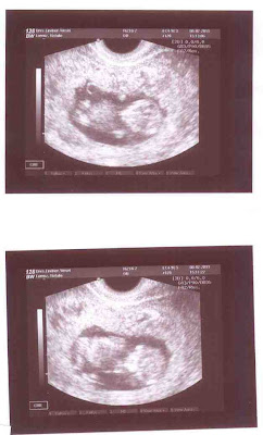 Wunder im Bauch: 12.SSW - Schon im 4. Monat und ein Grund zum Feiern!