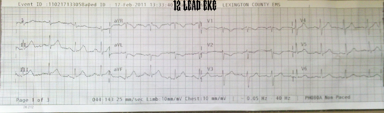 12 Lead EKG: February 2011