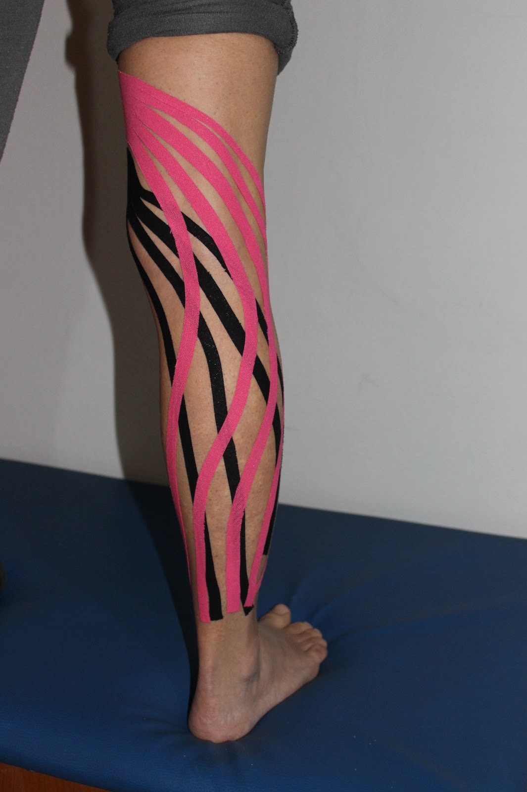 The Fascia Therapy Blog: Fascia Therapy --- Sports Injury and ...