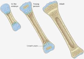 Law Web: Whether ossification test can be treated as conclusive for ...