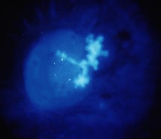 Photos For Herpes Simplex Keratitis (HSK) - Dendritic Corneal Ulcer ...