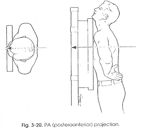 TEKNIK RADIOGRAFI DASAR - RADIOLOGI SCIENCES