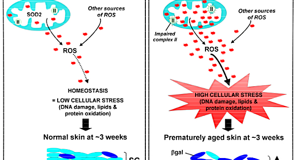 Neverland Research by Lab Fairy: ROS and skin aging