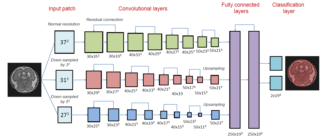 Fetal Brain Segmentation Using Deep Learning