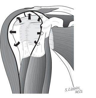 Shoulder Arthritis / Rotator Cuff Tears: causes of shoulder pain ...
