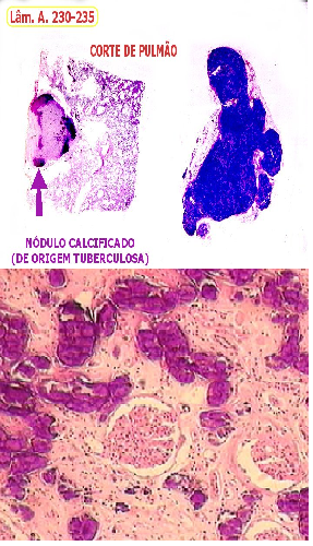 LAICI - Laboratório de Investigação de Câncer e Inflamação ...