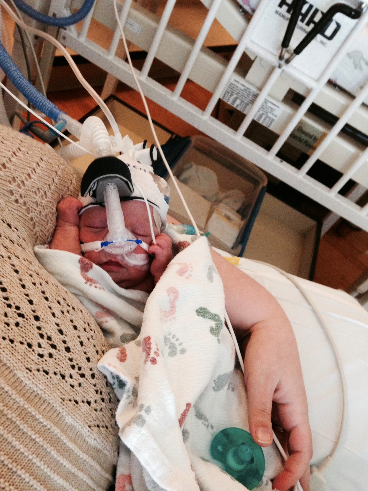 Natalie Rose - Daily Update of our Micro Preemie: PDA Ligation Surgery ...