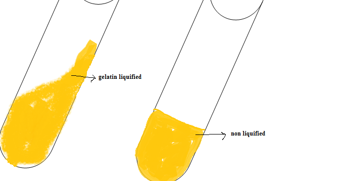 SENTHIL PRABHU SIVASAMY: Gelatin Hydrolysis Test