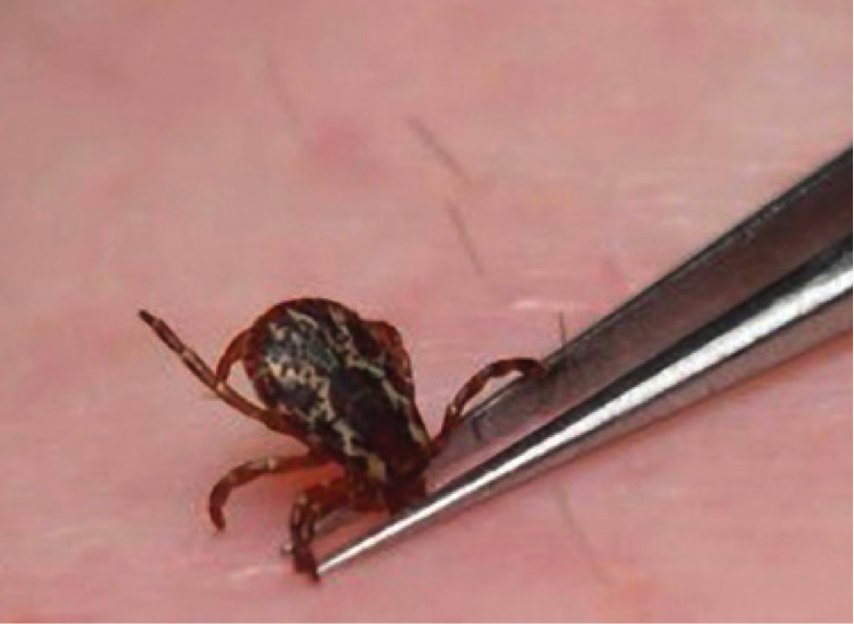 The Heather Trust: Sheep Ticks and the Tick Bite Prevention Week