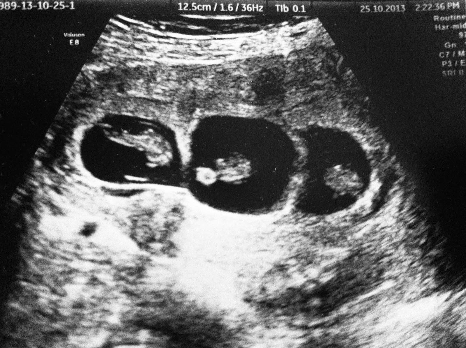 El triple papito: El comienzo de una aventura