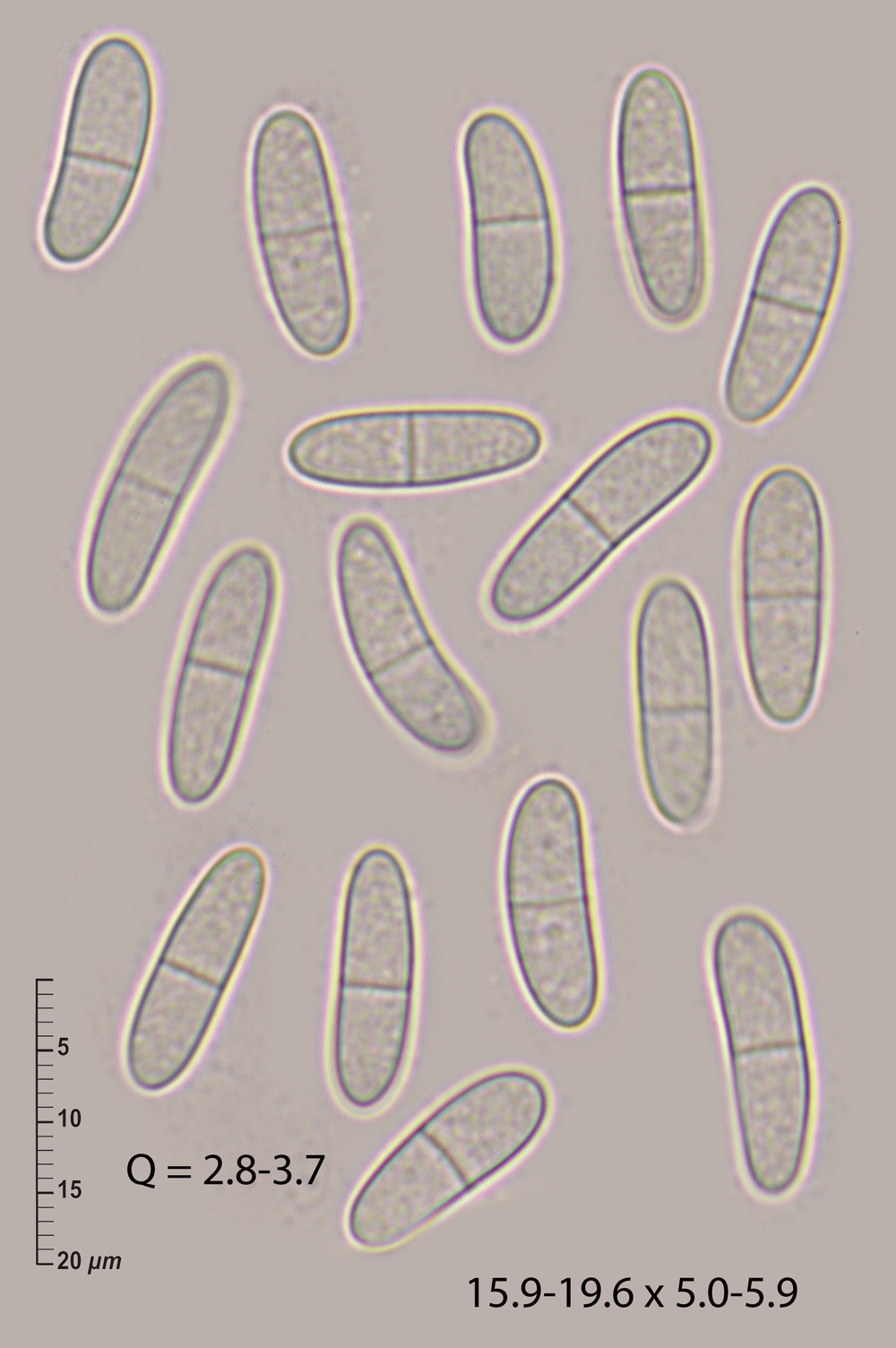 Encoeliopsis rhododendri (Ces. ex De Not.) Nannf. • CEMAS hongo ...