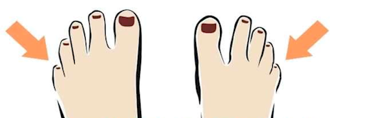 Healthy Solutions for All: Do Your Feet Look Like Any of These? That ...