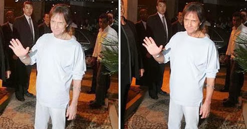 Como Roberto Carlos Perdeu A Perna