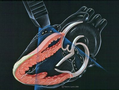 Medical Instrumentation: EchoKardio (Cardiac Echo)