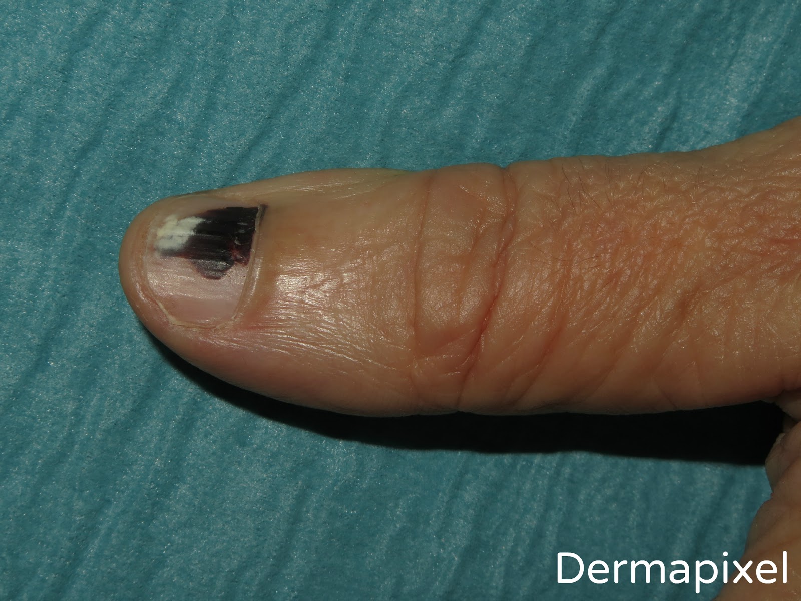 Dermapixel: agosto 2017