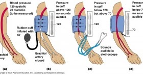 Si te matet shtypja e gjakut?