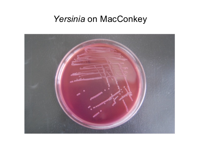 YERSINIA SPP. - Microbiology Laboratory Turkey
