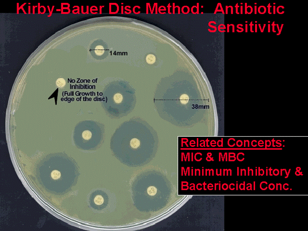 Praktikum Mikrobiologi #3: Systemic Bacteria & Tes Sensitivitas ...