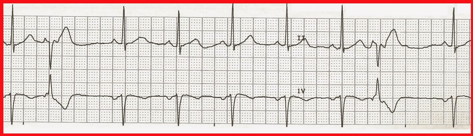 Practice EKG Rhythm Strips 219
