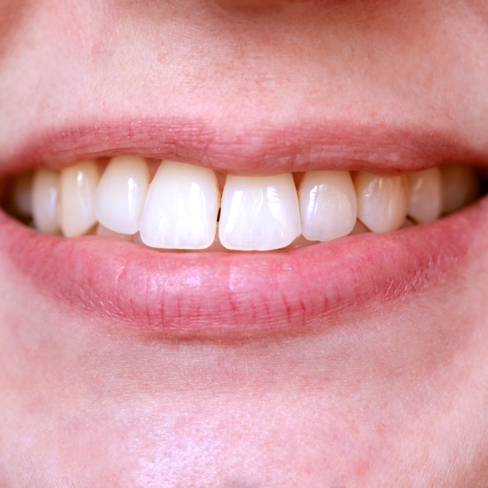 The Polished Hippy: Smile Brilliant Teeth Whitening System Review