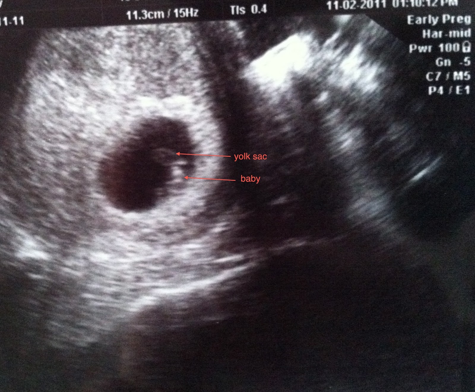 Pregnant And Plus Size February 2011