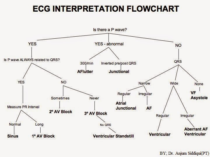 Knowledge Update : ECG interpretation - An easy way to remember