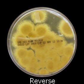 Fun With Microbiology (What's Buggin' You?): Paecilomyces variotii